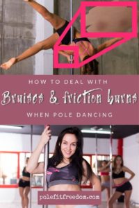 Care For Your Pole Dancing Bruises And Other Injuries - Pole Fit Freedom